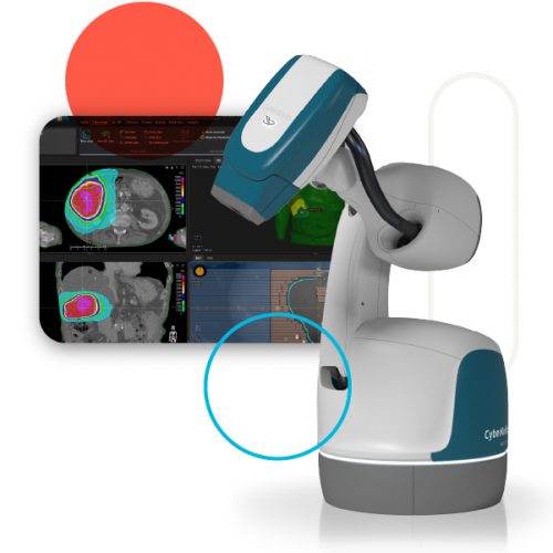 RayStation - Accuray