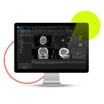 RayStation - Accuray