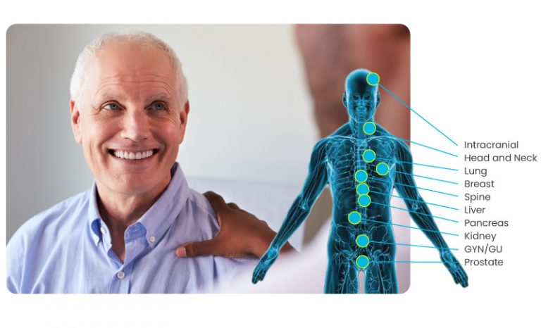 CyberKnife SRS / SBRT System from Accuray