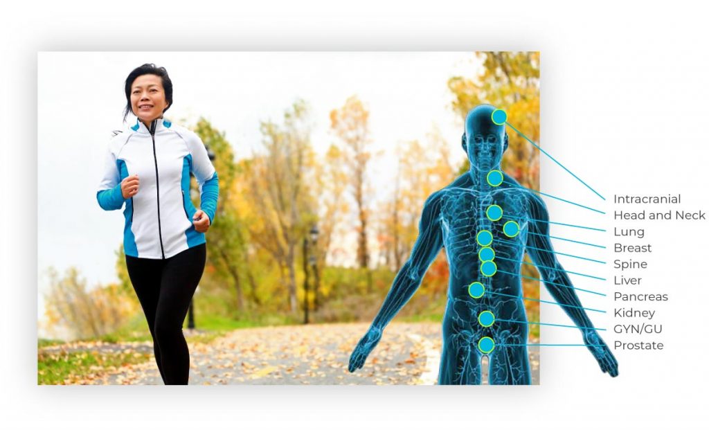 Radixact Radiation Therapy - Accuray