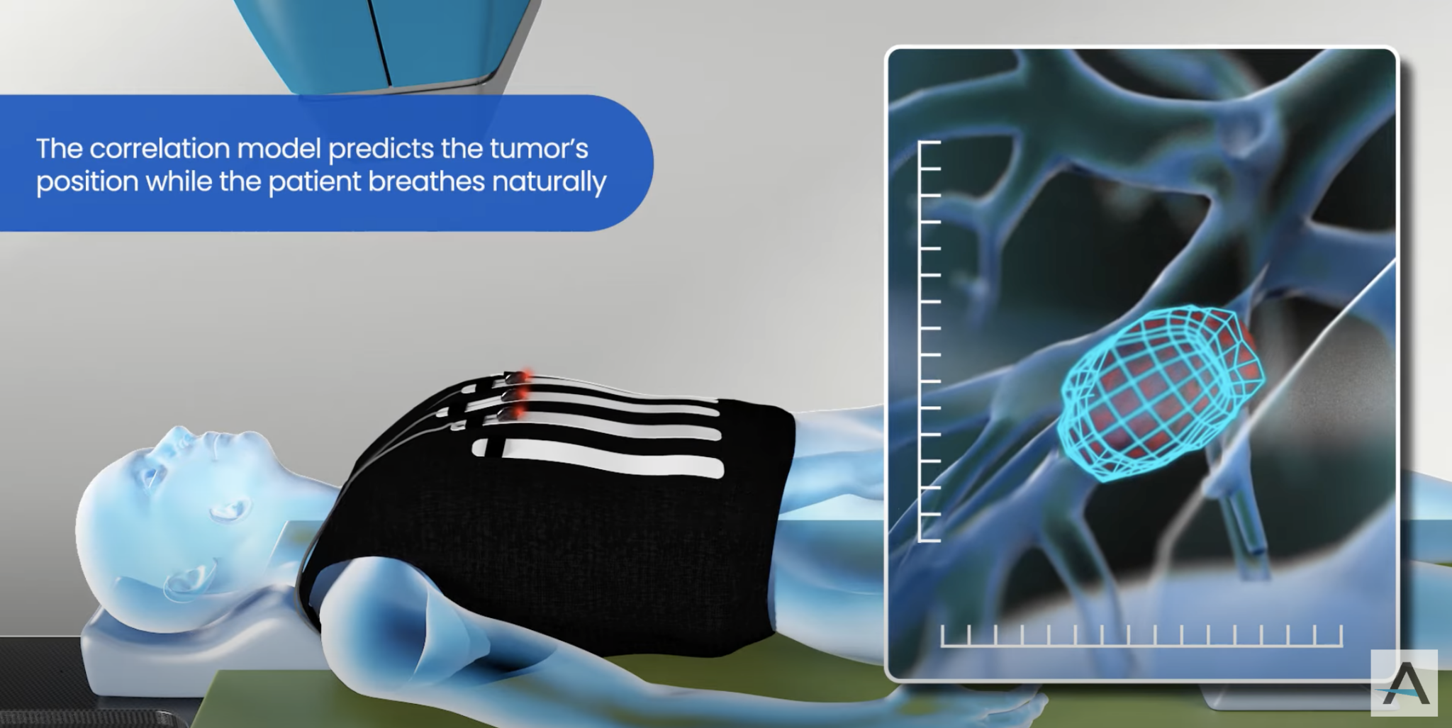 CyberKnife SRS / SBRT System from Accuray