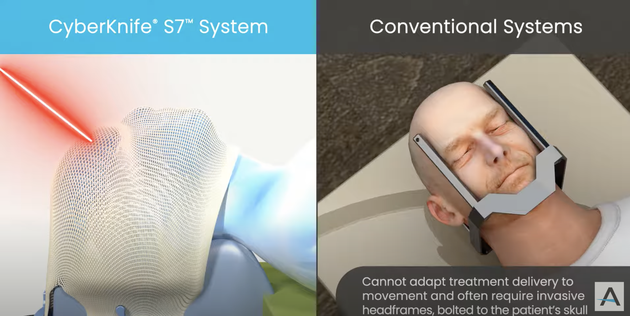 CyberKnife SRS / SBRT System from Accuray