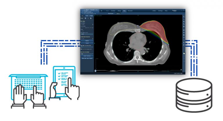 IDMS Data Management for Radiotherapy Treatment Planning - Accuray