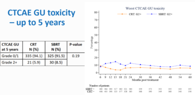 SBRT for Prostate Cancer: Understanding the PACE-B Trial