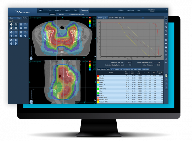 Precision Radiotherapy Treatment Planning - Accuray