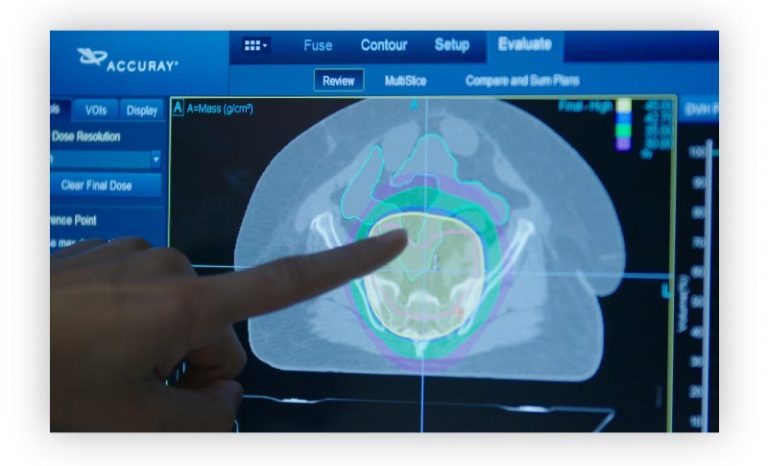 IDMS Data Management for Radiotherapy Treatment Planning - Accuray